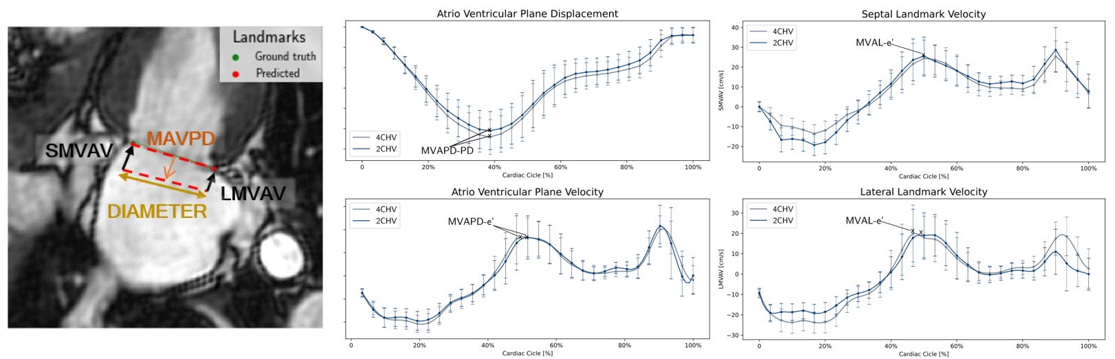 Fully automatic extraction of mitral valve annulus motion parameters on long axis CINE CMR using ...
