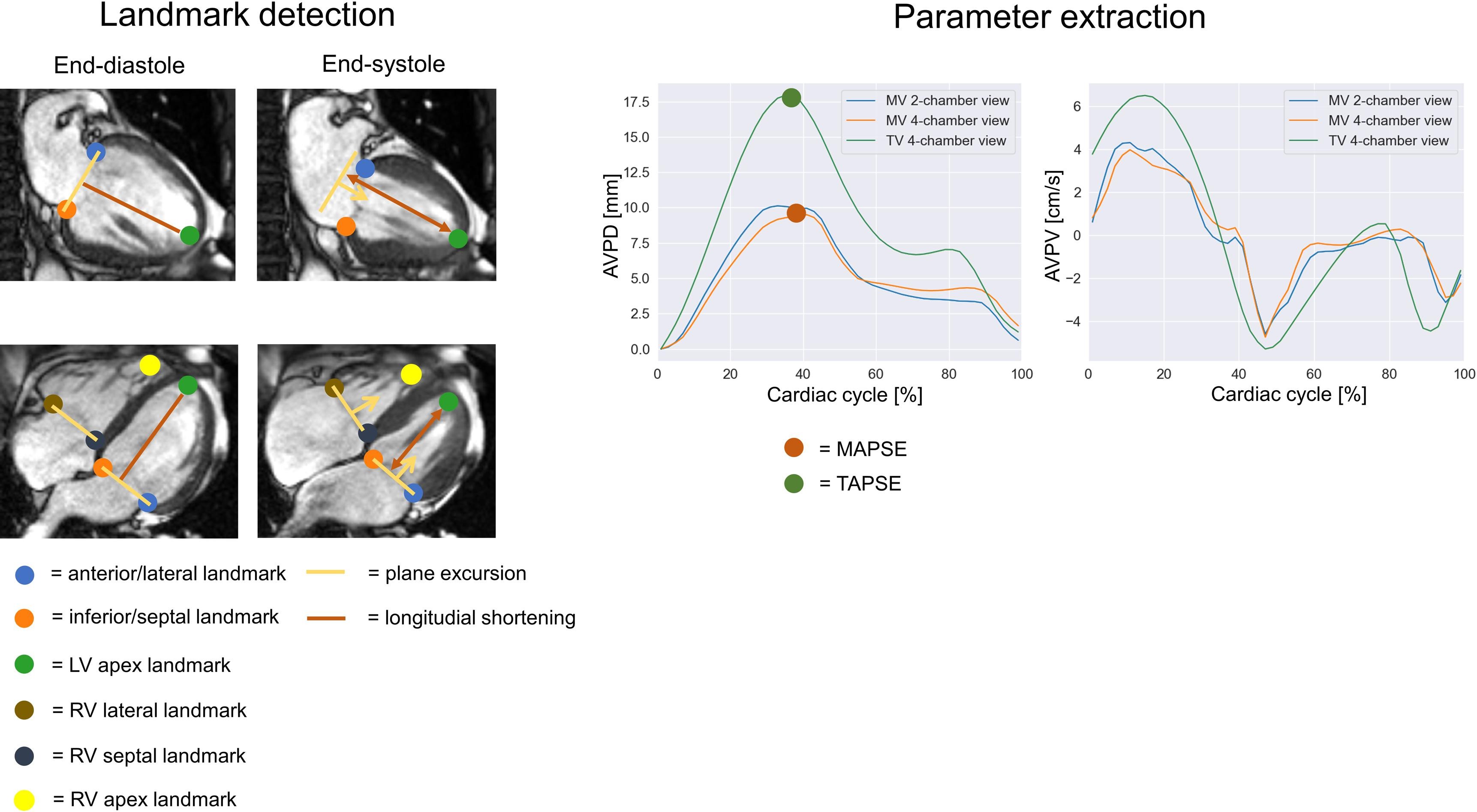 Fully automated AI-based cardiac motion parameter extraction – application to mitral and ...